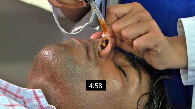 Nasaya | earache | headache | decreased vision | snoring